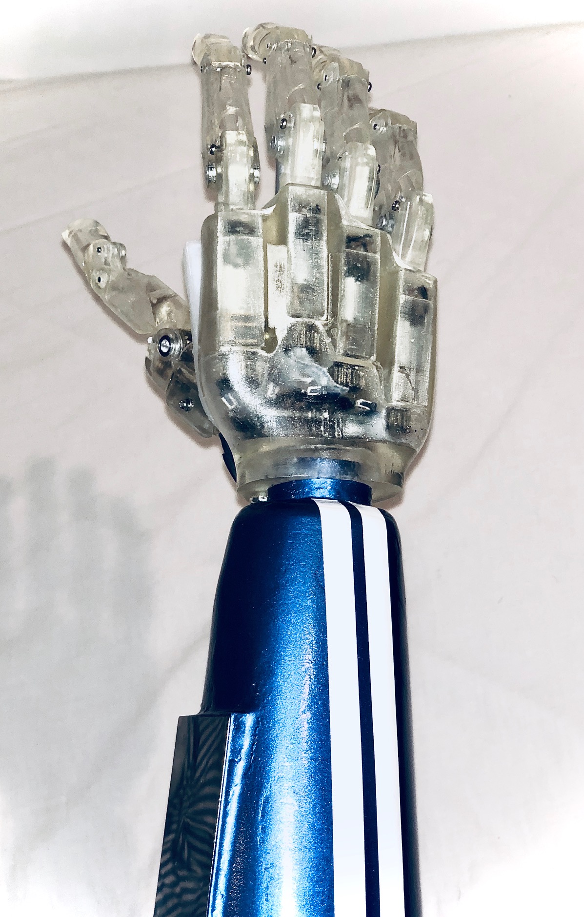 Low Cost Electronic Prosthetic Hand With An Artificial Intelligence (AI ...