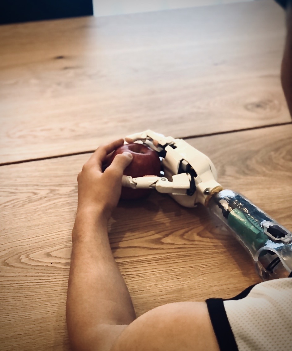 Low Cost Electronic Prosthetic Hand With An Artificial Intelligence (AI ...